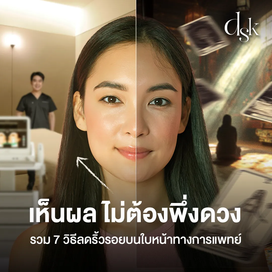 รวม 7 วิธีลดริ้วรอยบนใบหน้าทางการแพทย์ เห็นผลจริง ไม่ต้องพึ่งดวง