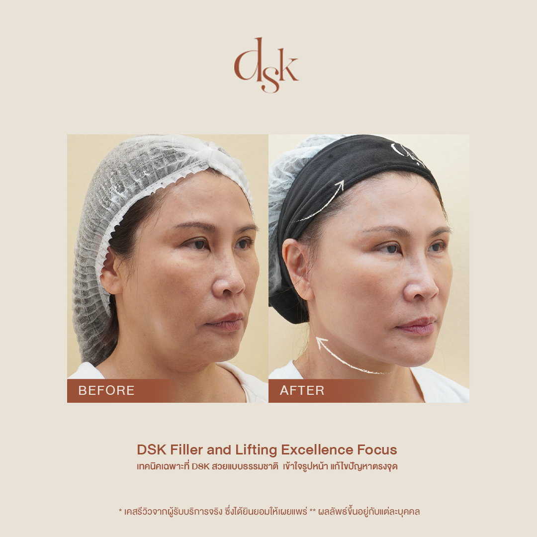 Program Filler - DSK Clinic I The First Customized Clinic