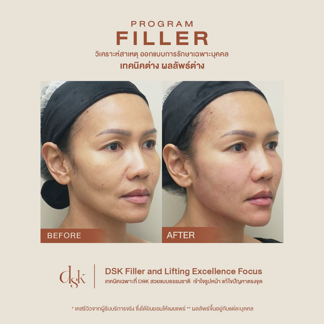 Program Filler - DSK Clinic I The First Customized Clinic