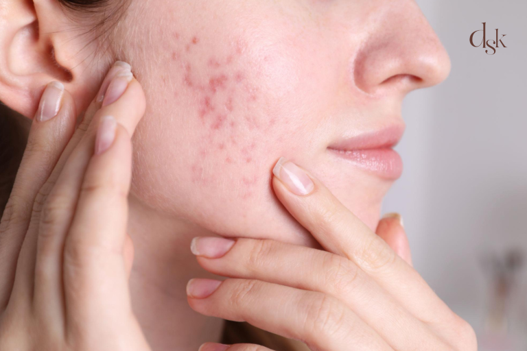 What is a Pico Laser ? How many types and benefits offer?